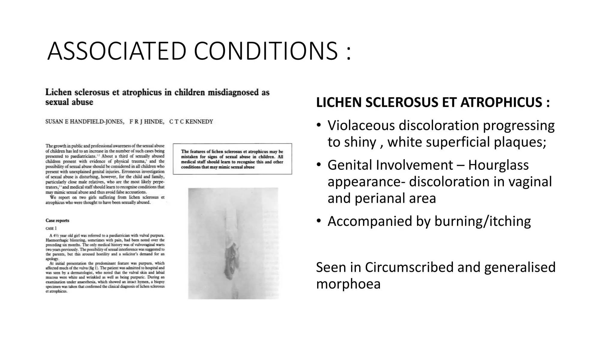 LOCALISED SCLERODERMA.pptx