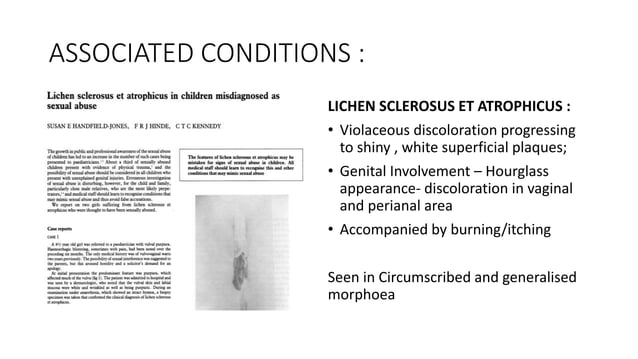 LOCALISED SCLERODERMA.pptx