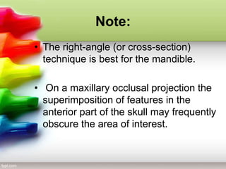 object Localization in intraoral radiographies | PPTX