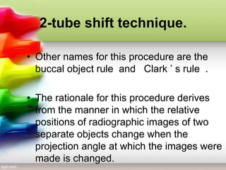 object Localization in intraoral radiographies | PPTX