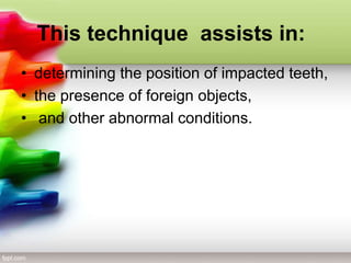 object Localization in intraoral radiographies | PPT