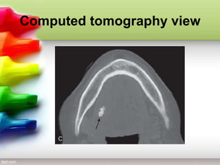 object Localization in intraoral radiographies | PPT