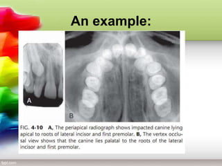 object Localization in intraoral radiographies | PPT