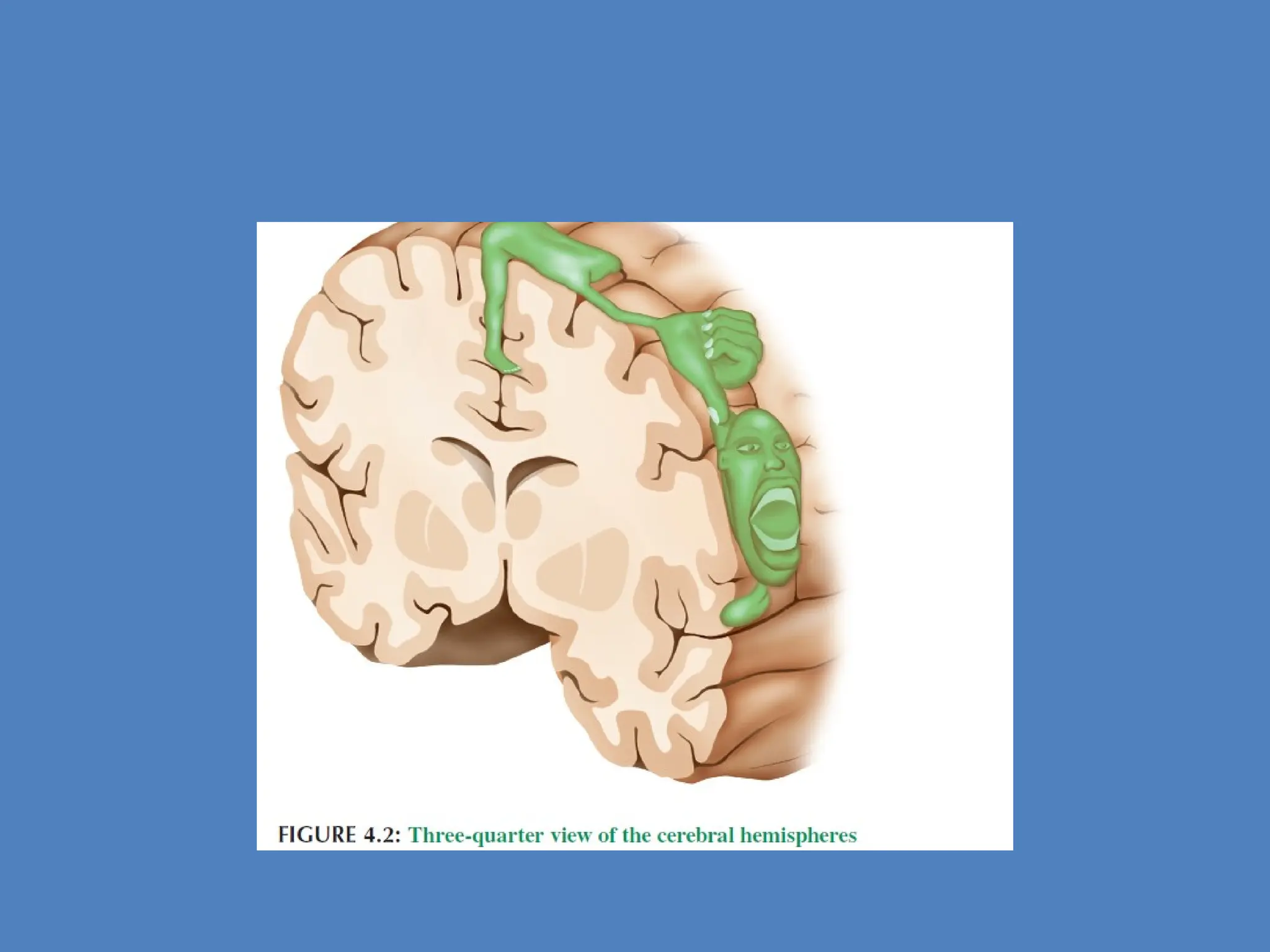 localization of disorders in neurosurgery .pptx