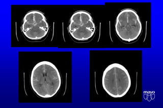 Localization and DDx for Fam Prac.ppt