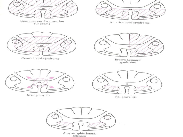 Localization In Clinical Neurology | PPT