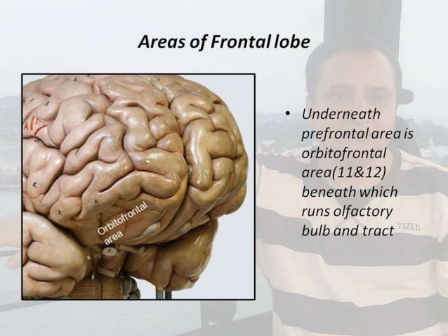 Localization of brain lesion by Prof Dr Bashir Ahmed Dar Sopore Kashmir ...