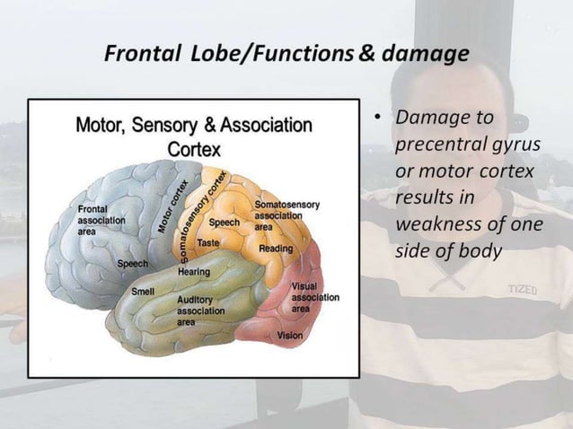 Localization of brain lesion by Prof Dr Bashir Ahmed Dar Sopore Kashmir ...