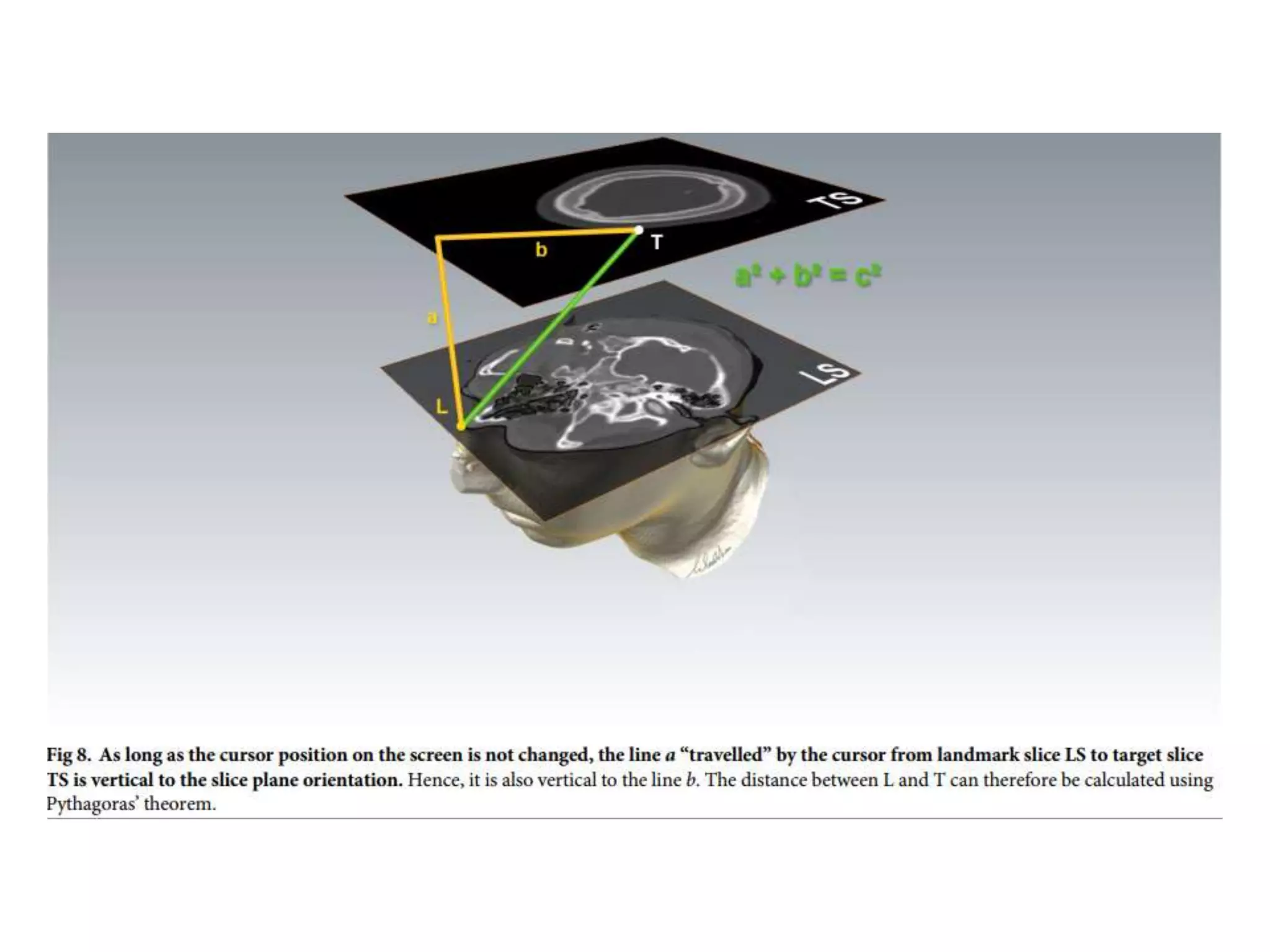 Localization of brain lesions | PPTX