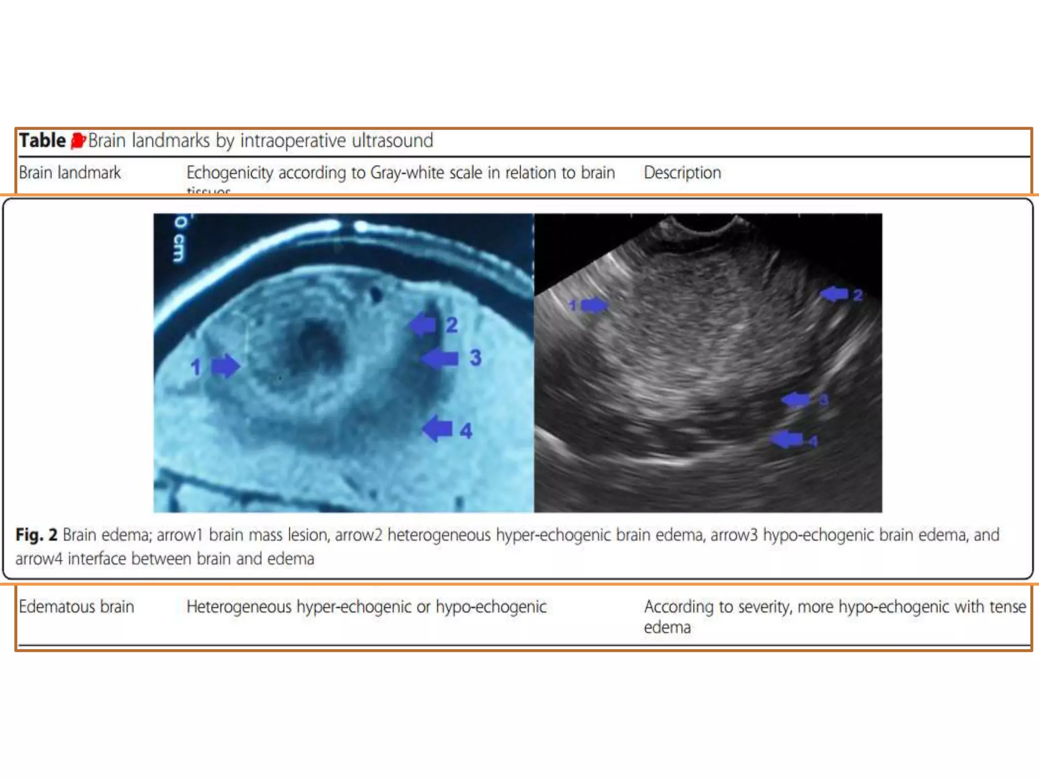 Localization of brain lesions | PPTX