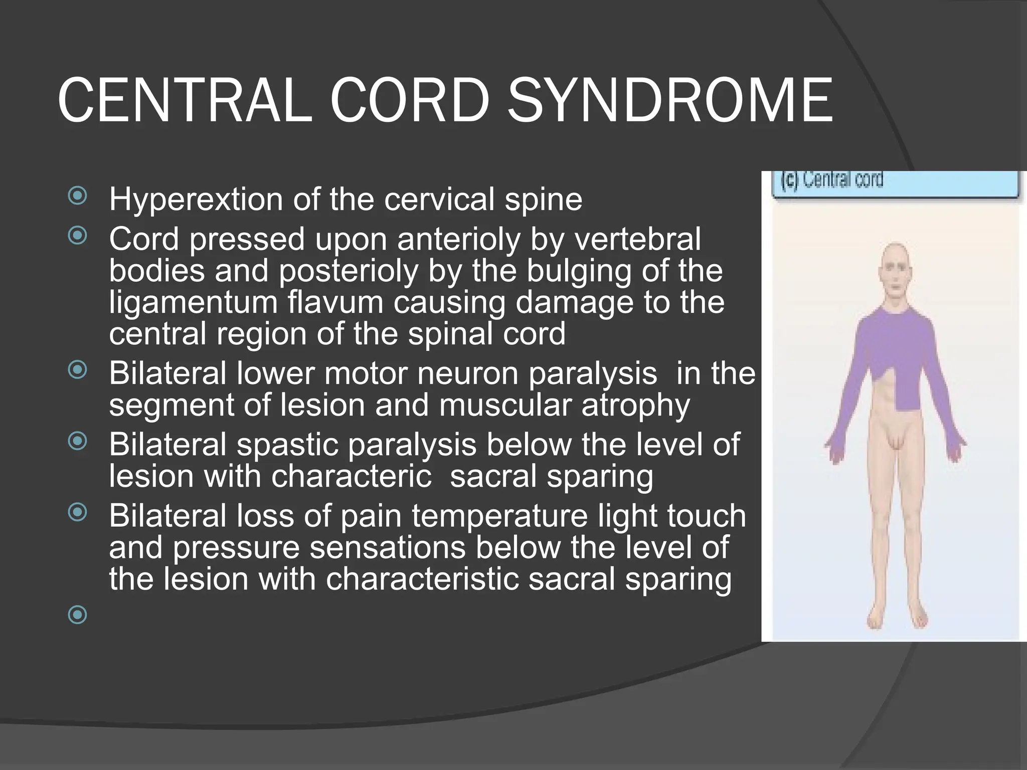 LOCALIZATION OFCENTRAL NERVOUS SYSTEM LESIONS | PPT