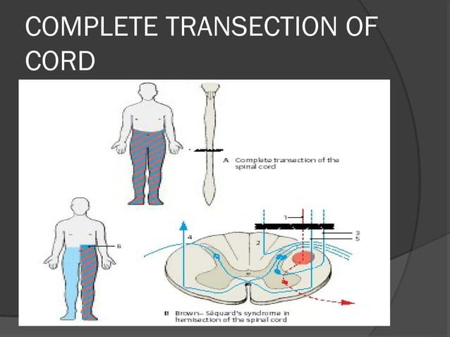 LOCALIZATION OFCENTRAL NERVOUS SYSTEM LESIONS | PPT
