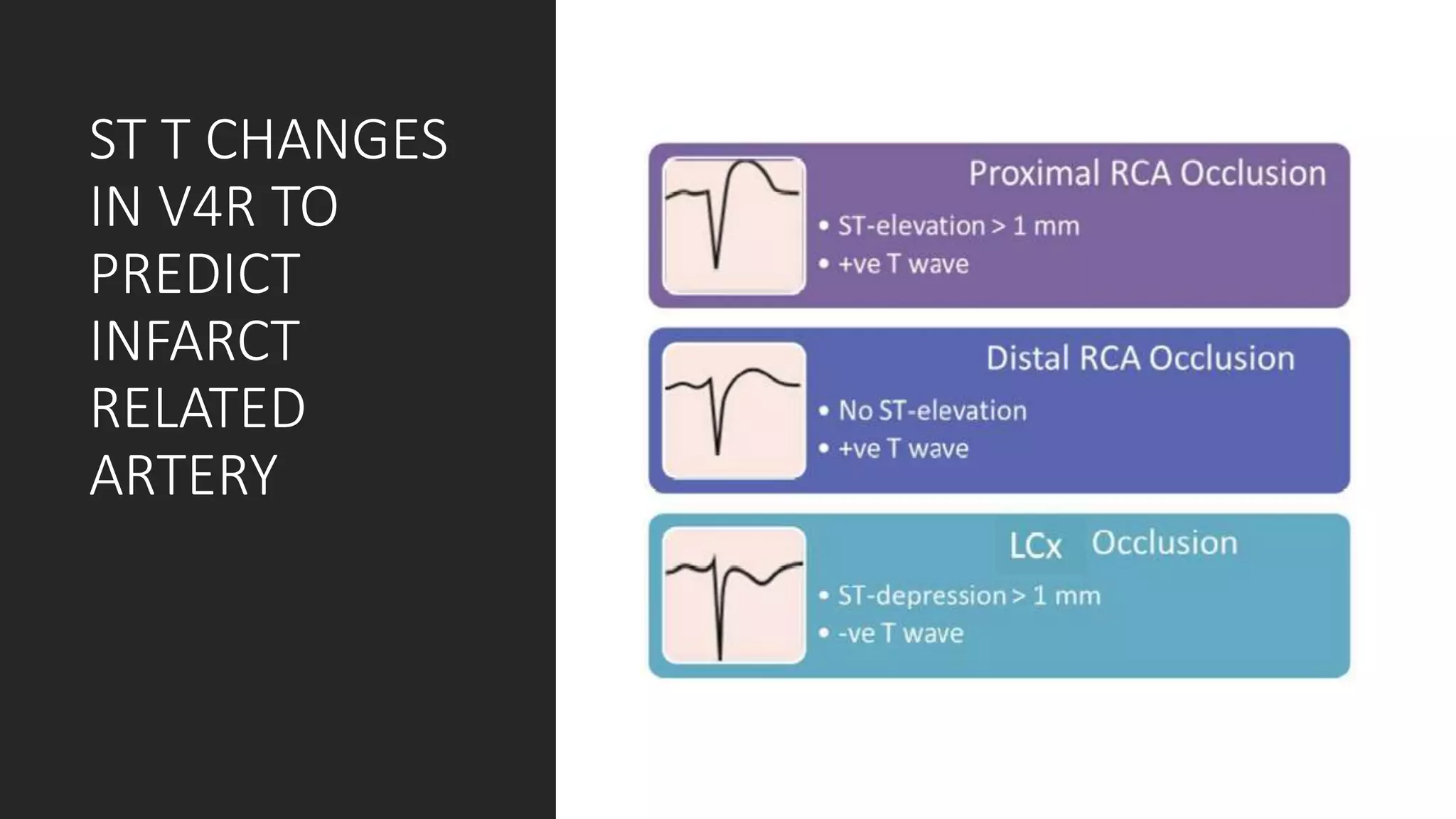 LOCALIZATION OF INFARCT RELATED CORONARY ARTERIES.pptx | Heart and ...