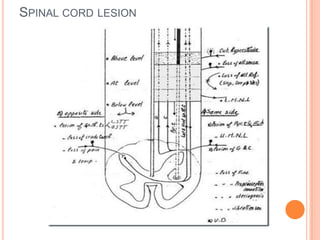 Localization of lesion in hemiplegia | PPTX