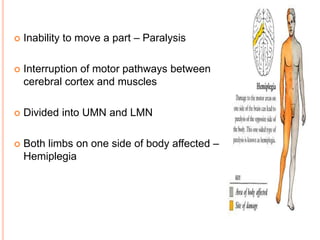 Localization of lesion in hemiplegia | PPTX
