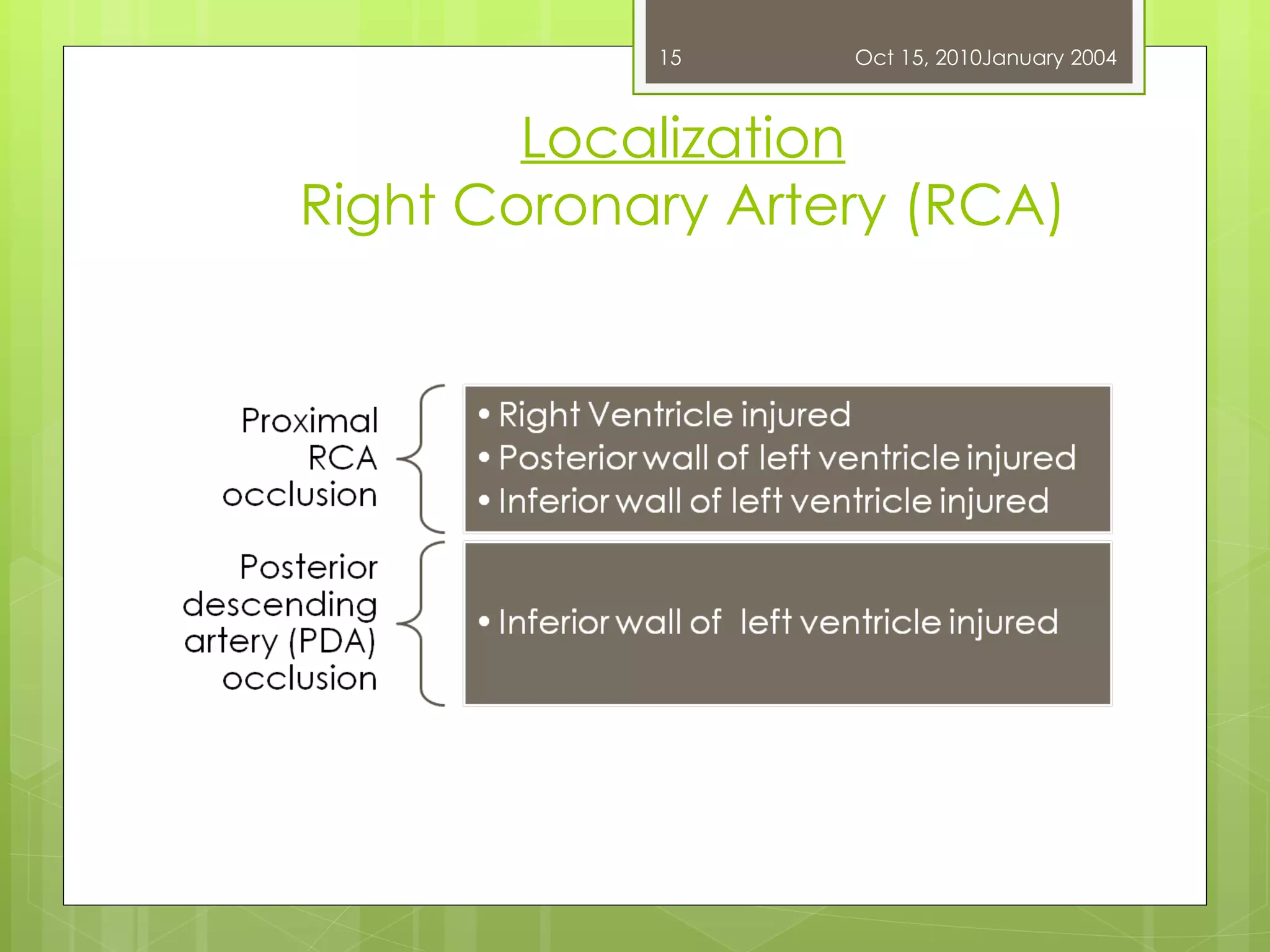 Localization of MI on ECG | PPT