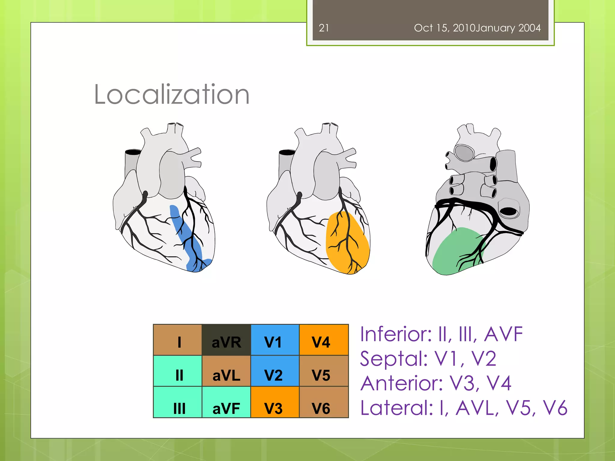 Localization of MI on ECG | PPT