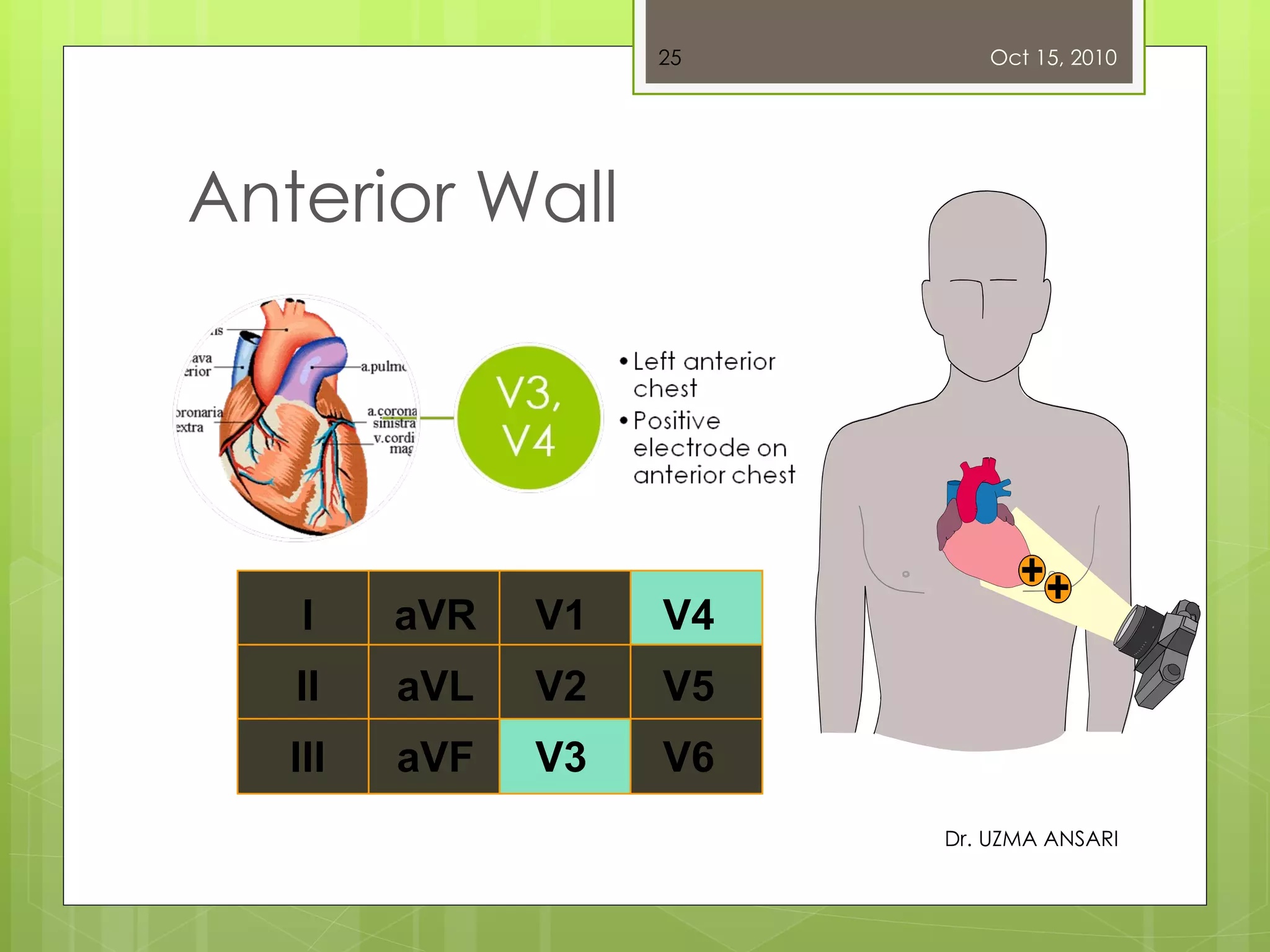 Localization of MI on ECG | PPT