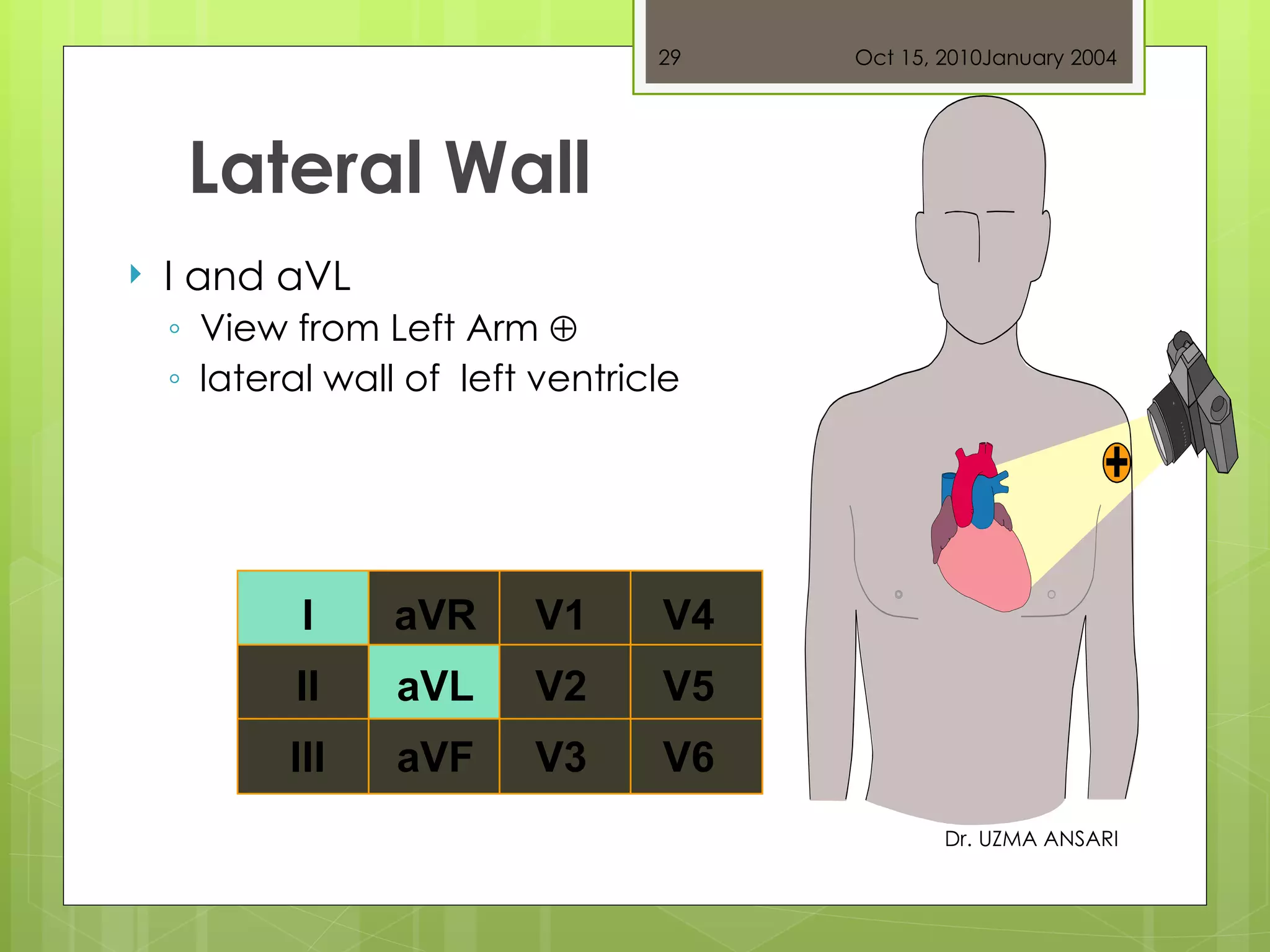 Localization of MI on ECG | PPT