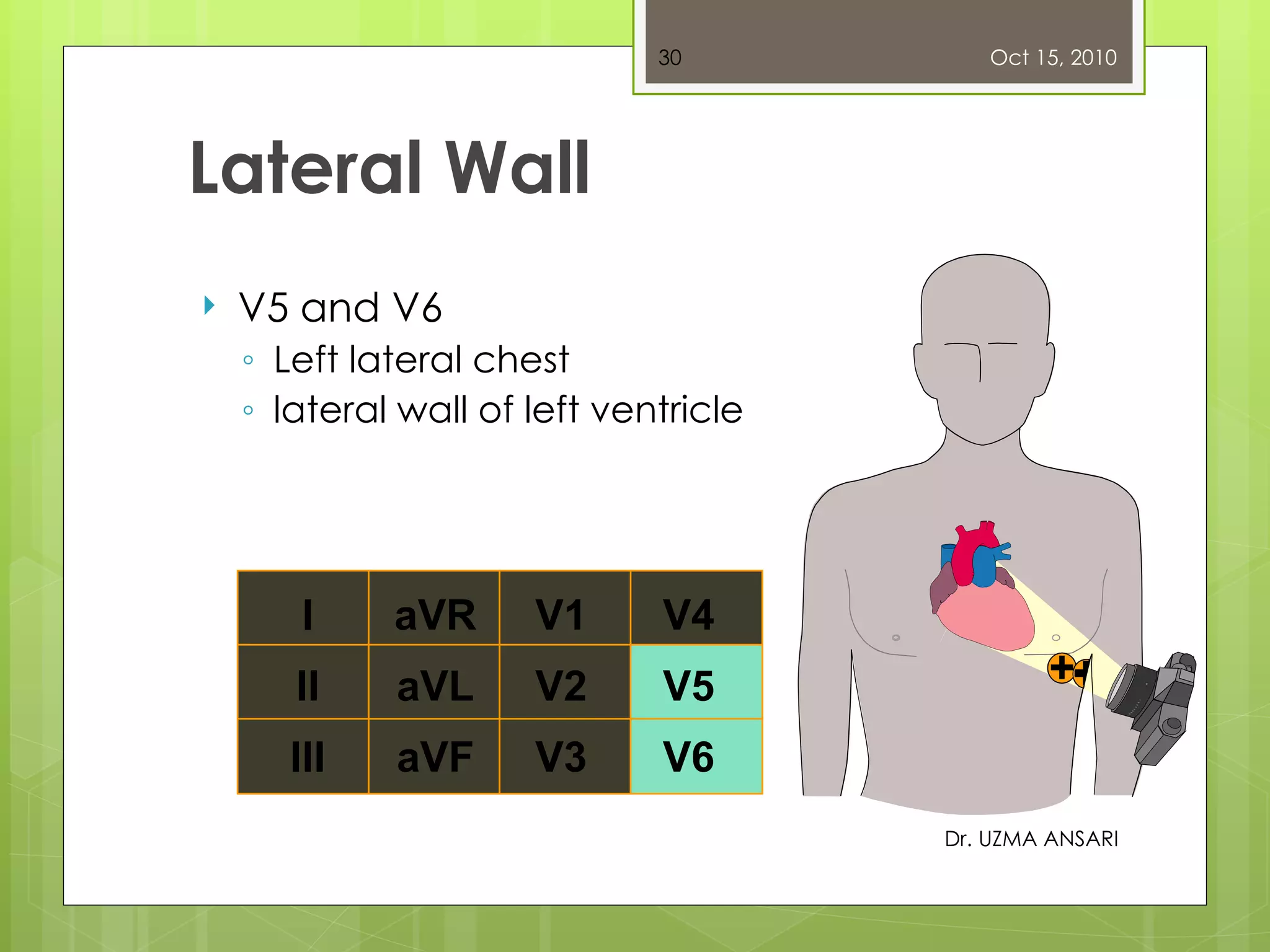 Localization of MI on ECG | PPT