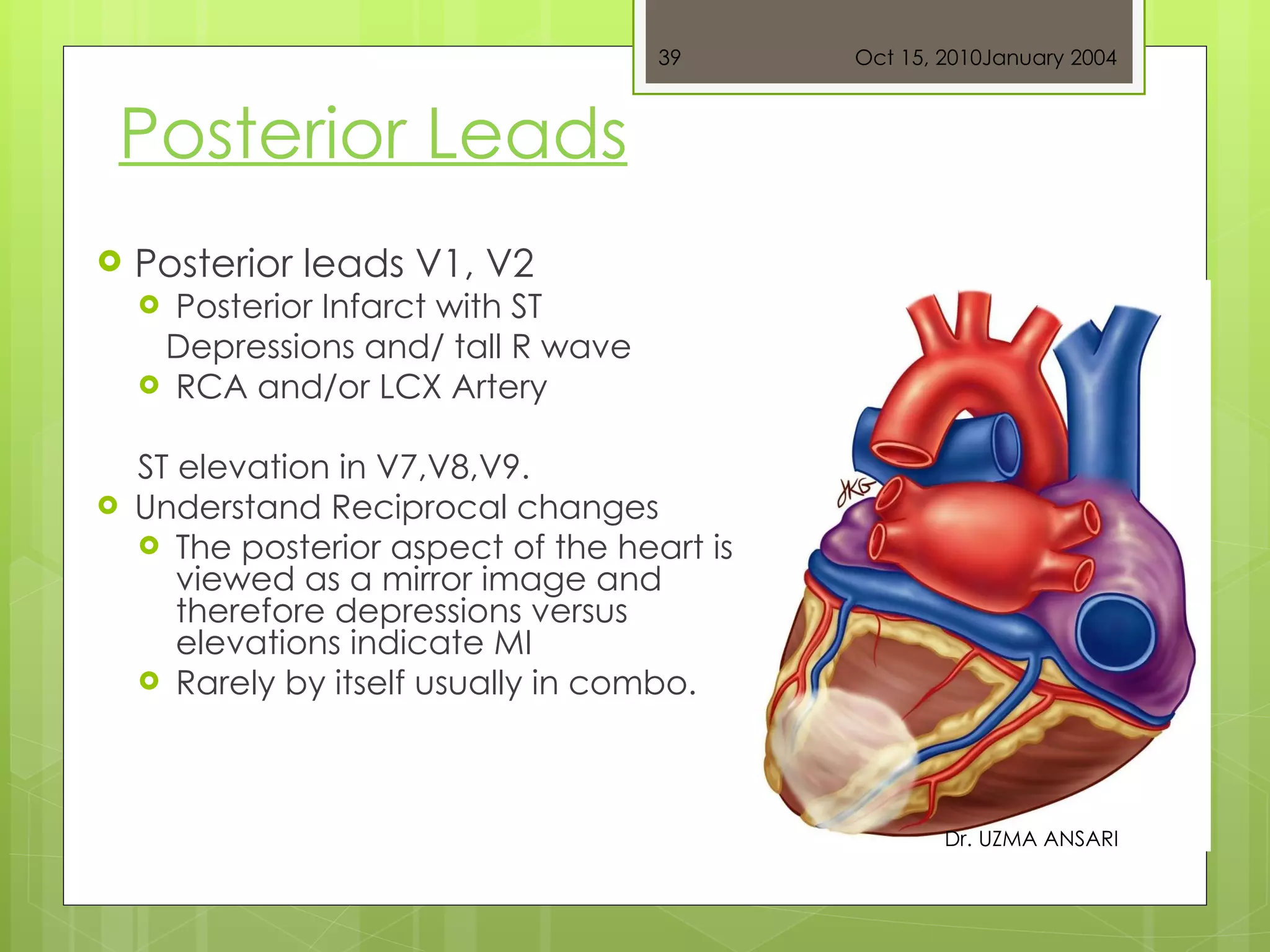 Localization of MI on ECG | PPT