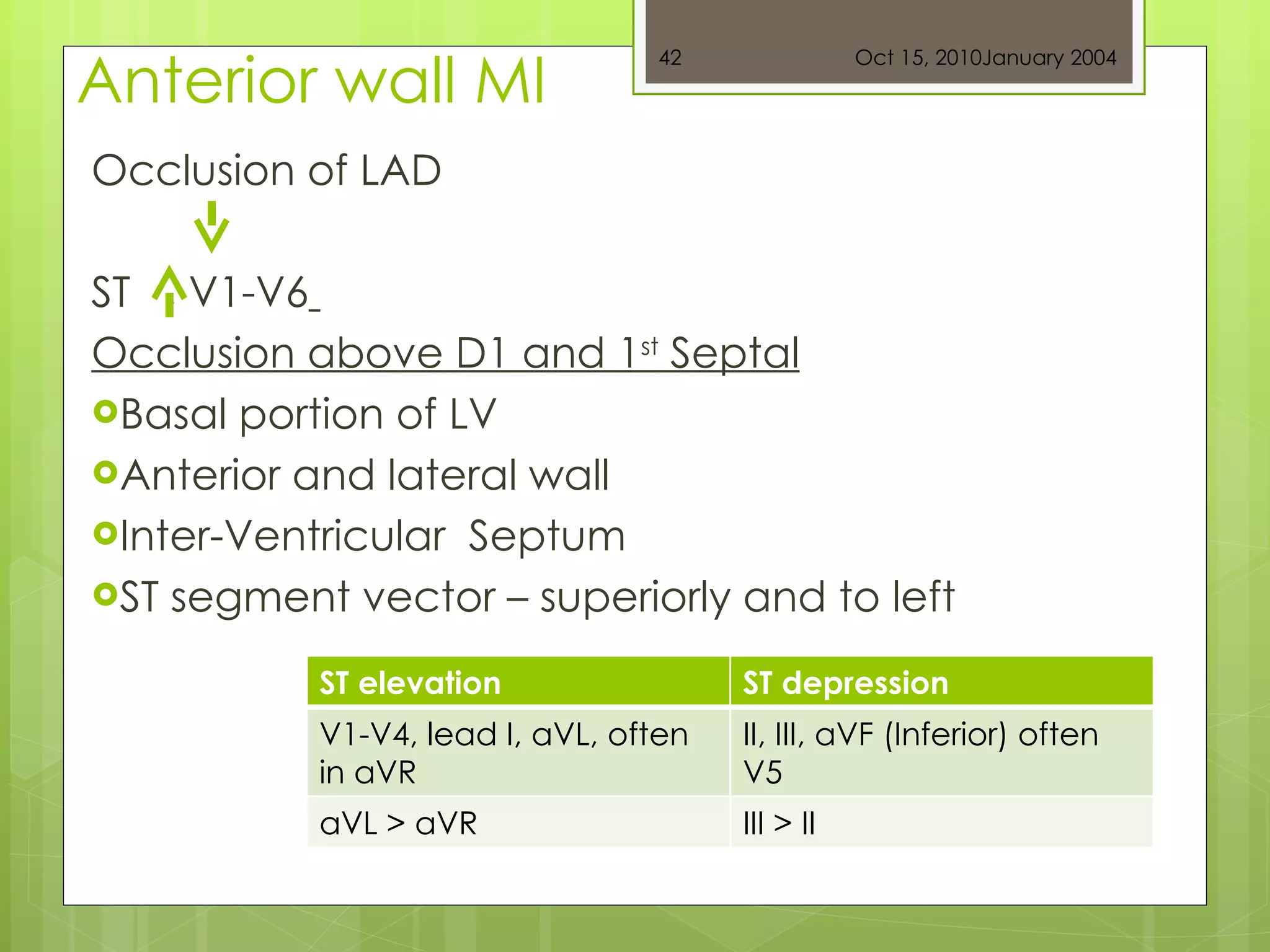 Localization of MI on ECG | PPT