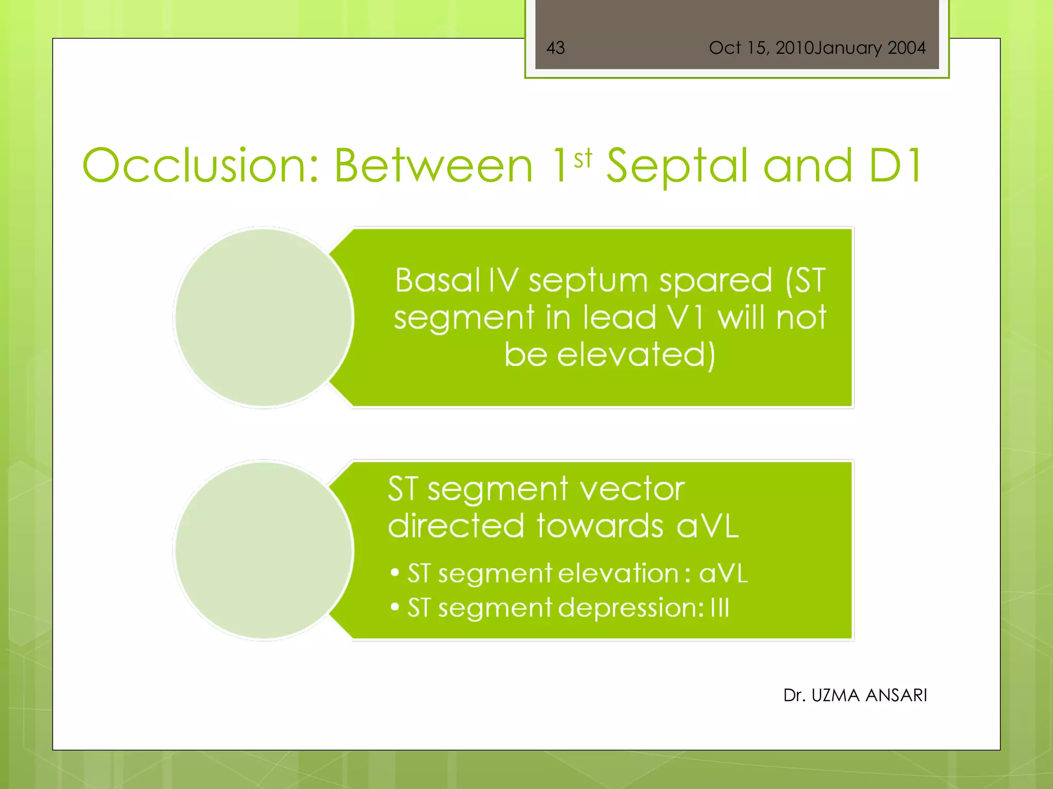 Localization of MI on ECG | PPT