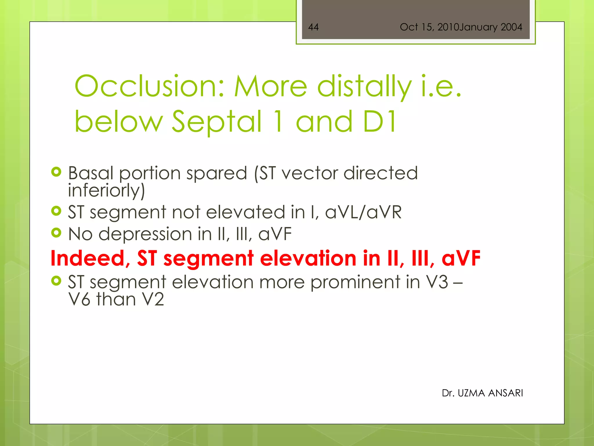 Localization of MI on ECG | PPT