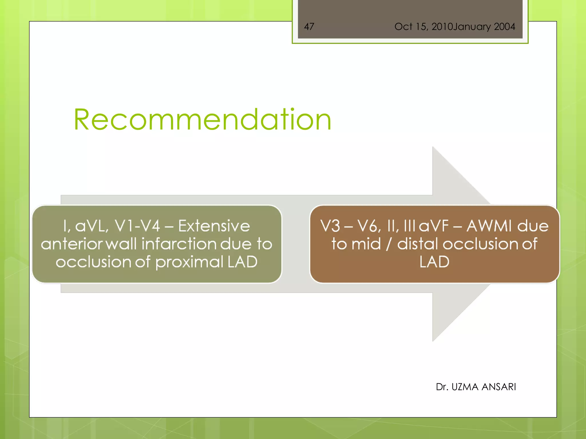 Localization of MI on ECG | PPT
