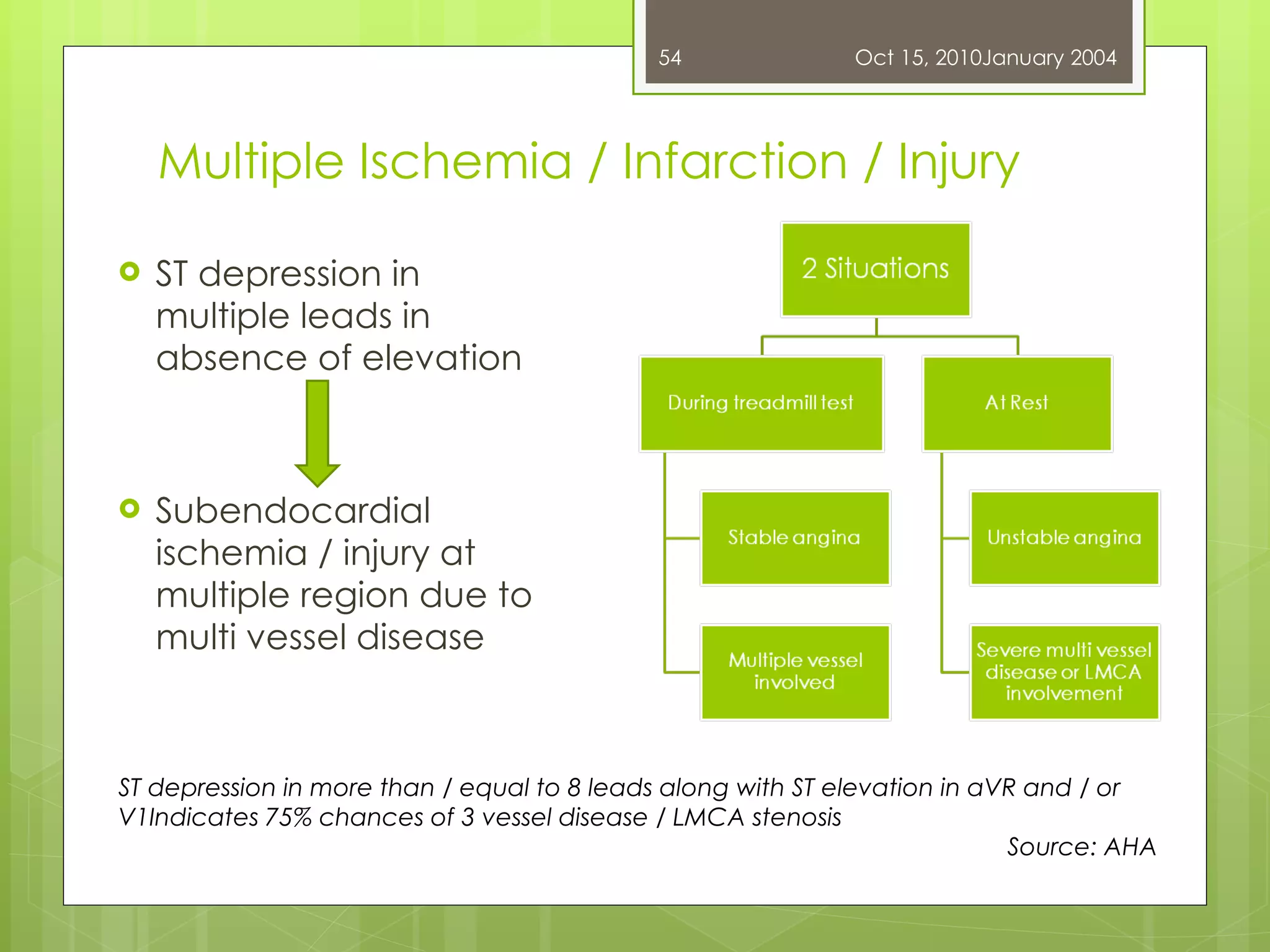 Localization of MI on ECG | PPT
