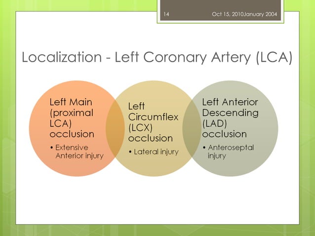 Localization of MI on ECG | PPT | Heart and Cardiovascular Diseases ...