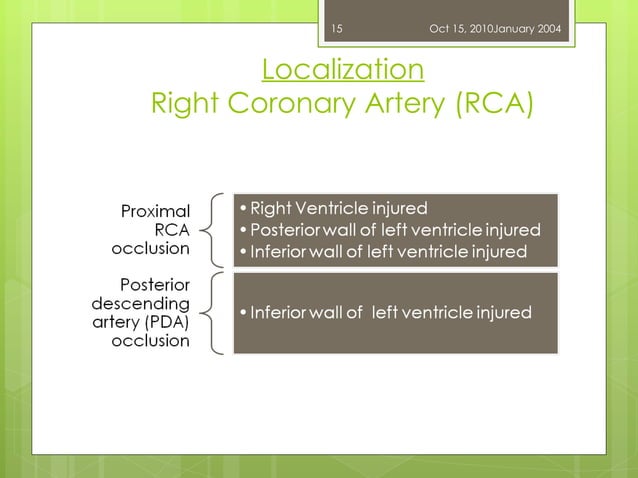 Localization of MI on ECG | PPT | Heart and Cardiovascular Diseases ...