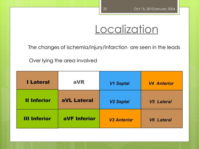 Localization of MI on ECG | PPT | Heart and Cardiovascular Diseases ...