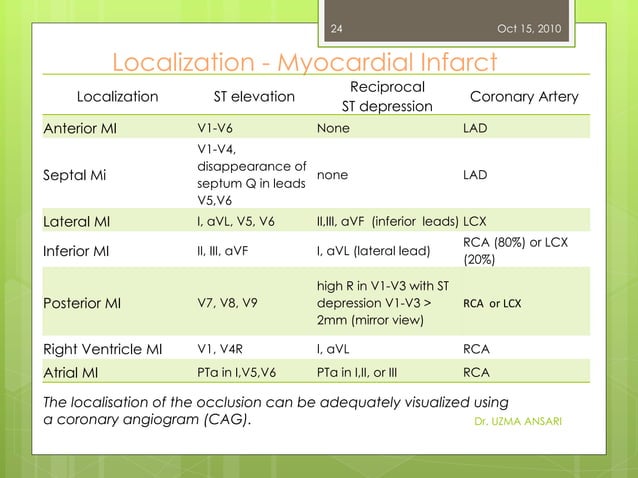 Localization of MI on ECG | PPT | Heart and Cardiovascular Diseases ...