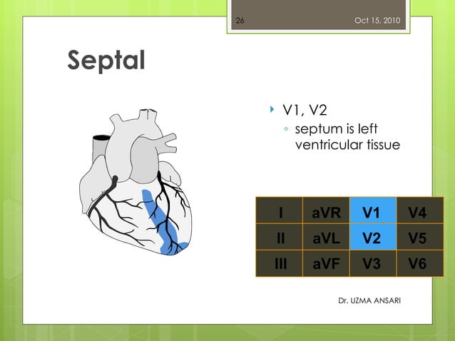 Localization of MI on ECG | PPT | Heart and Cardiovascular Diseases ...