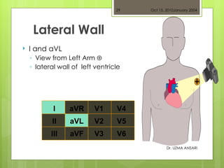 Localization of MI on ECG | PPT