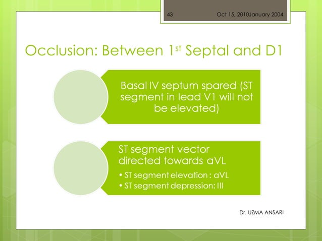 Localization of MI on ECG | PPT | Heart and Cardiovascular Diseases ...