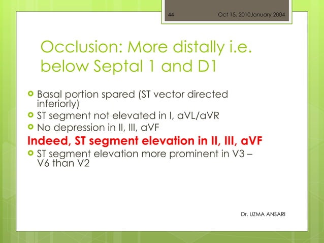 Localization of MI on ECG | PPT | Heart and Cardiovascular Diseases ...