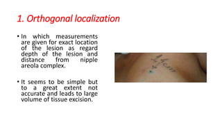 Localization of non palpable breast tumor for surgery | PPTX