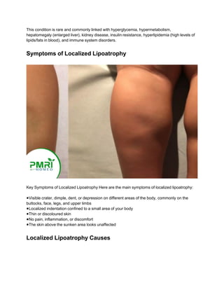 Localized Lipoatrophy_ Causes, Symptoms and Treatment.ppt