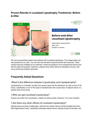 Localized Lipoatrophy_ Causes, Symptoms and Treatment.ppt