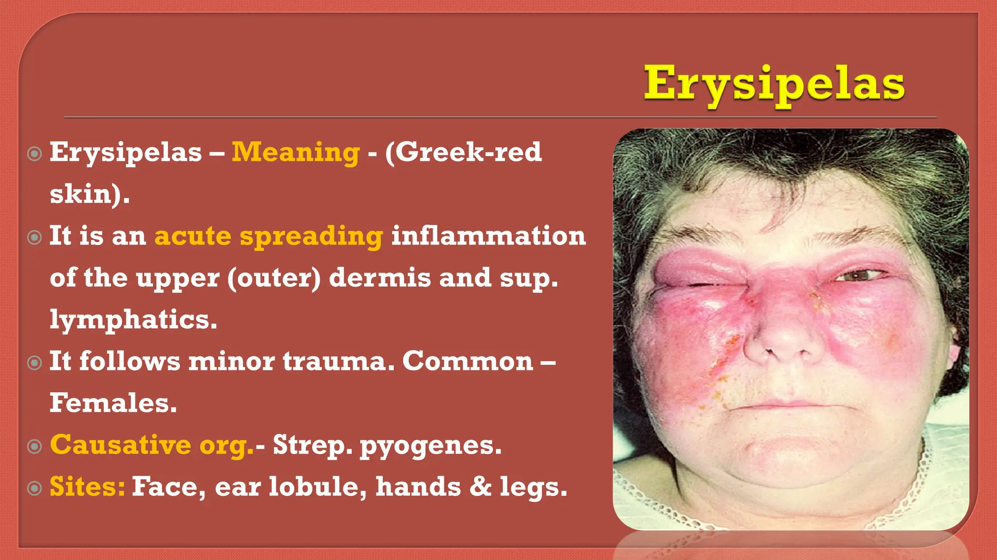 Localized Surgical Infections.pdf