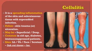 Localized Surgical Infections.pdf