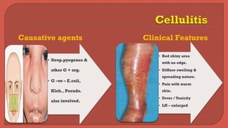 Localized Surgical Infections.pdf