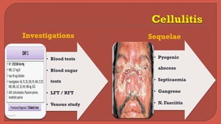 Localized Surgical Infections.pdf