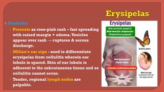 Localized Surgical Infections.pdf