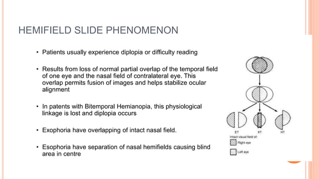 Localizing signs for lesion of visual pathway | PPTX