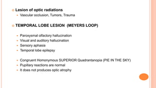 Localizing signs for lesion of visual pathway | PPTX