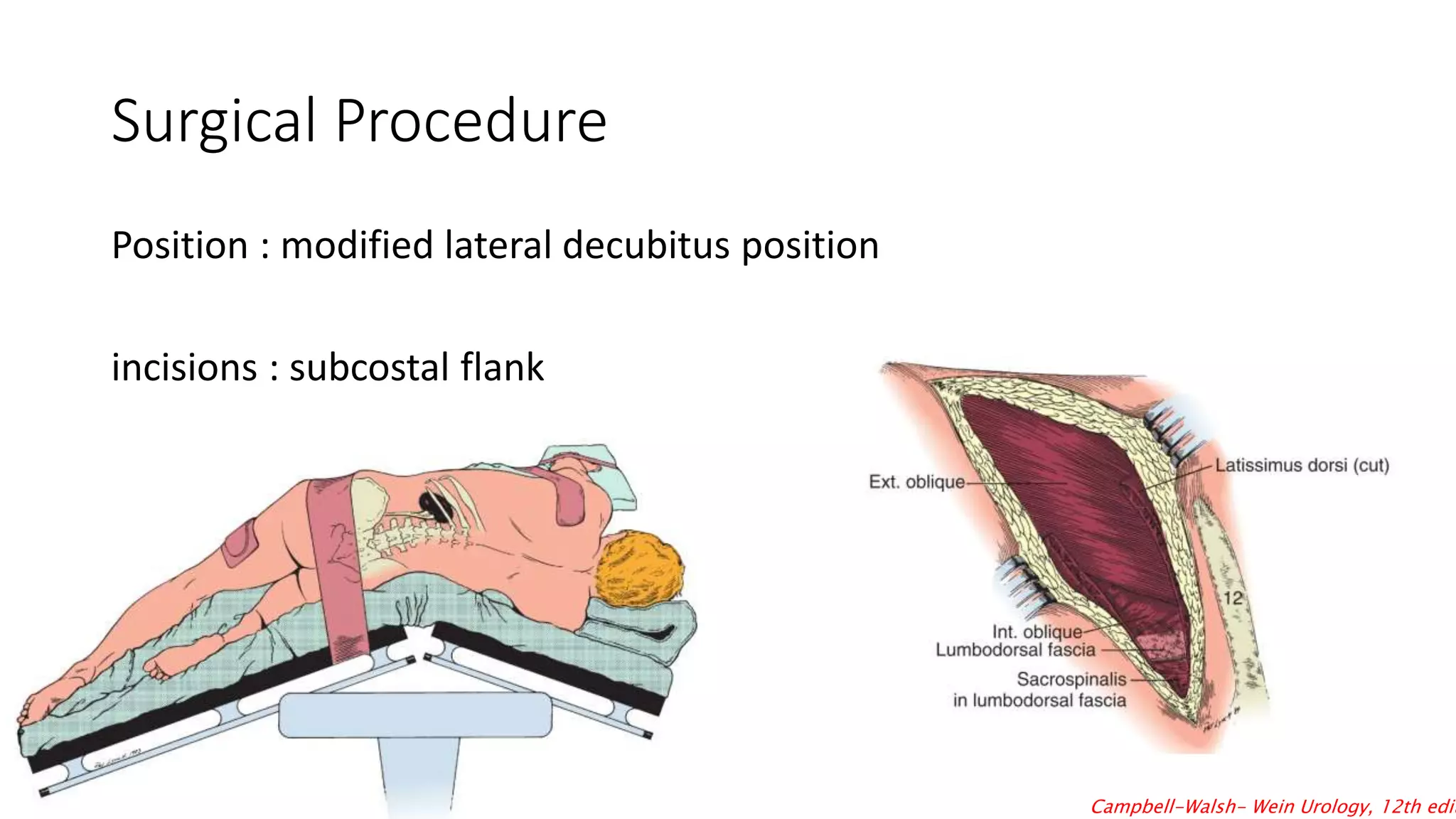 Locally advanced renal cell carcinoma RCC | PPTX