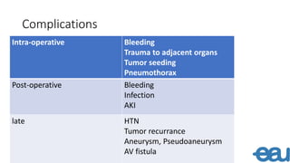 Locally advanced renal cell carcinoma RCC | PPTX